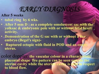 Ectopic pregnancy- Define, Type, Etiology, Sign and Symptoms, Treatment ...