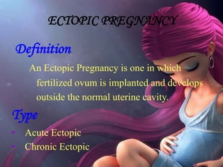 Ectopic pregnancy- Define, Type, Etiology, Sign and Symptoms, Treatment ...