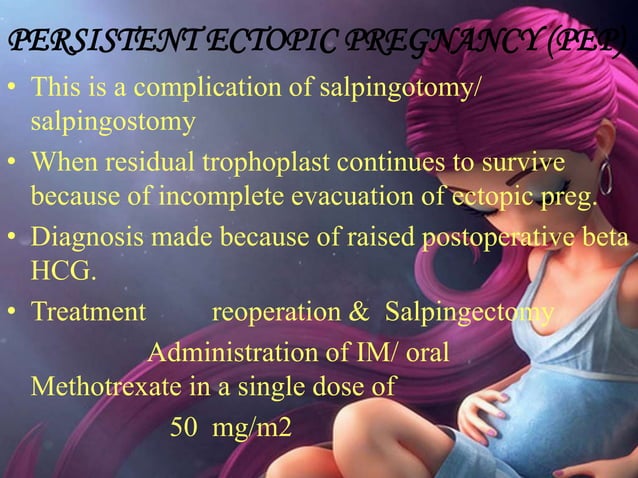Ectopic Pregnancy Define Type Etiology Sign And Symptoms Treatment
