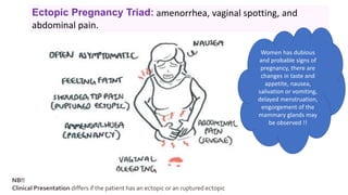 ectopic pregnancy.pptx