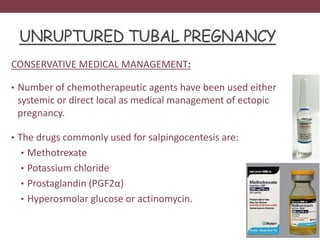 ECTOPIC PREGNANCY | PPTX