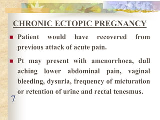 ECTOPIC PREGNANCY.ppt