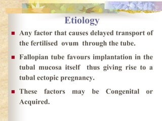 ECTOPIC PREGNANCY.ppt