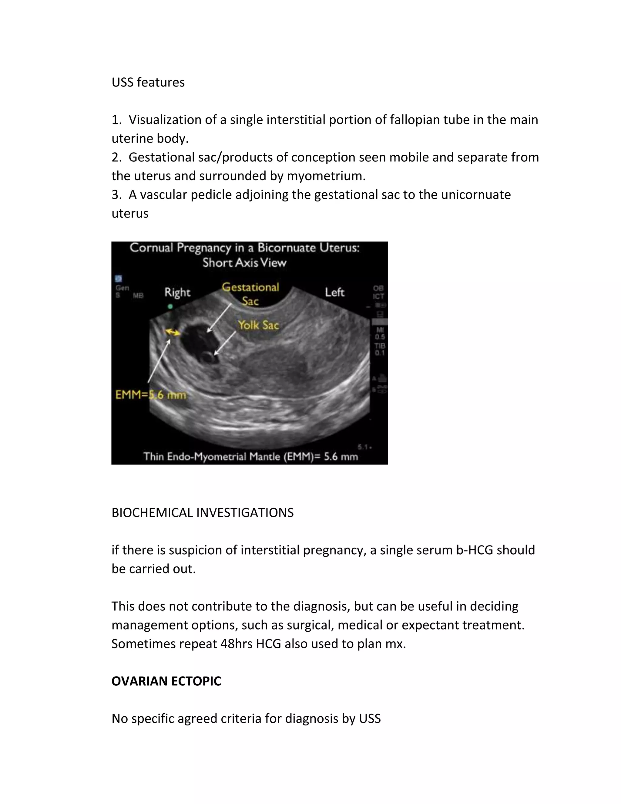 ECTOPIC PREGNANCY.docx