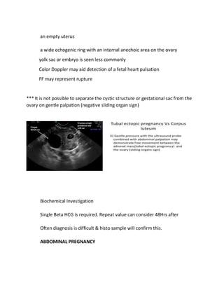ECTOPIC PREGNANCY.docx