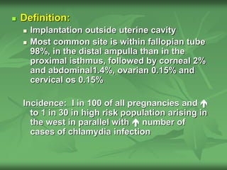 ectopic pregnancy.ppt