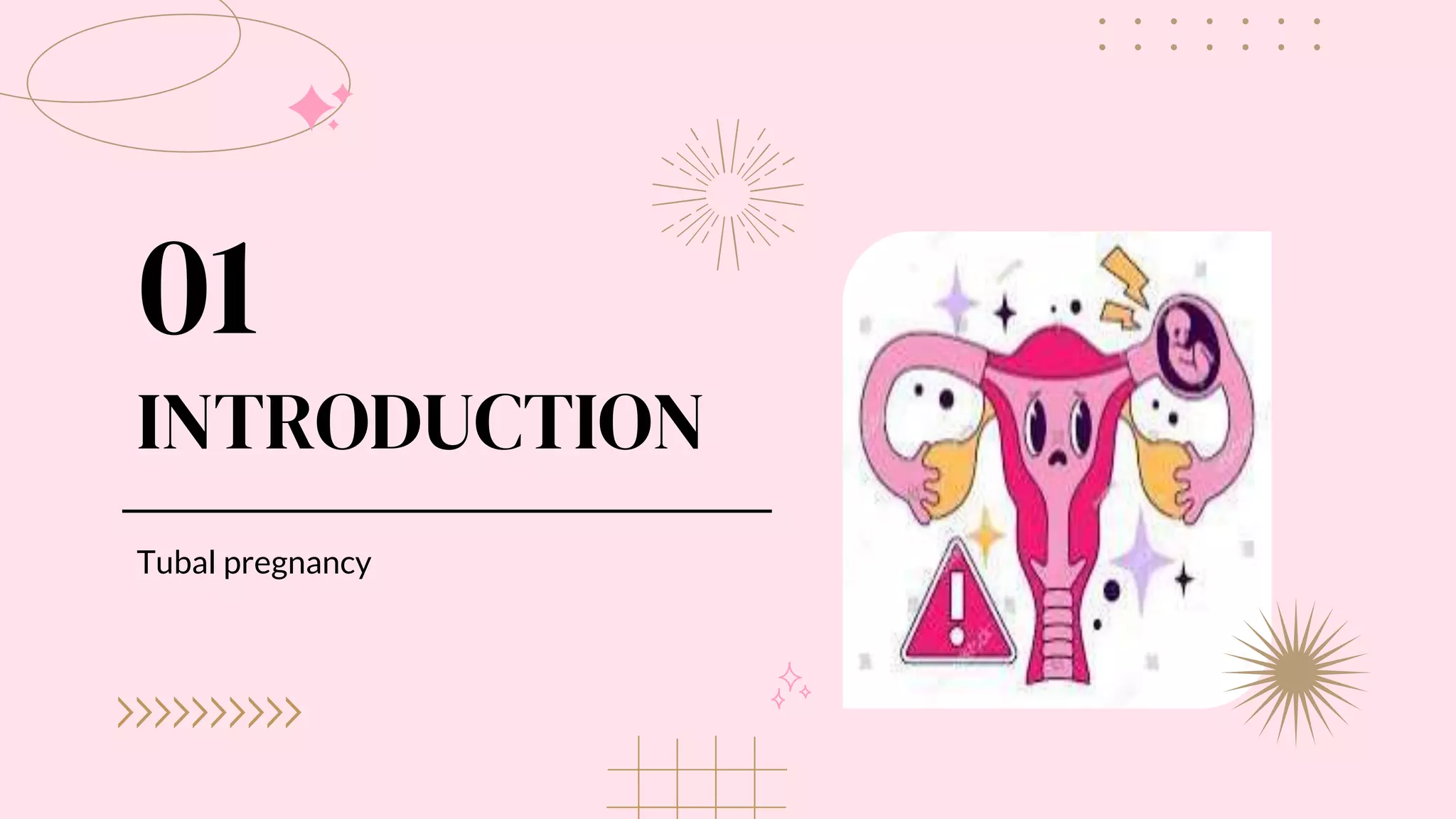 Ectopic pregnancy.pptx