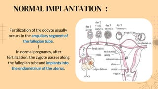 Ectopic pregnancy.pptx