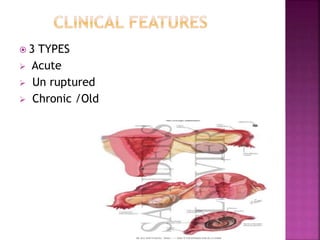 ectopic pregnancy in obstetric and gyanaecology | PPTX