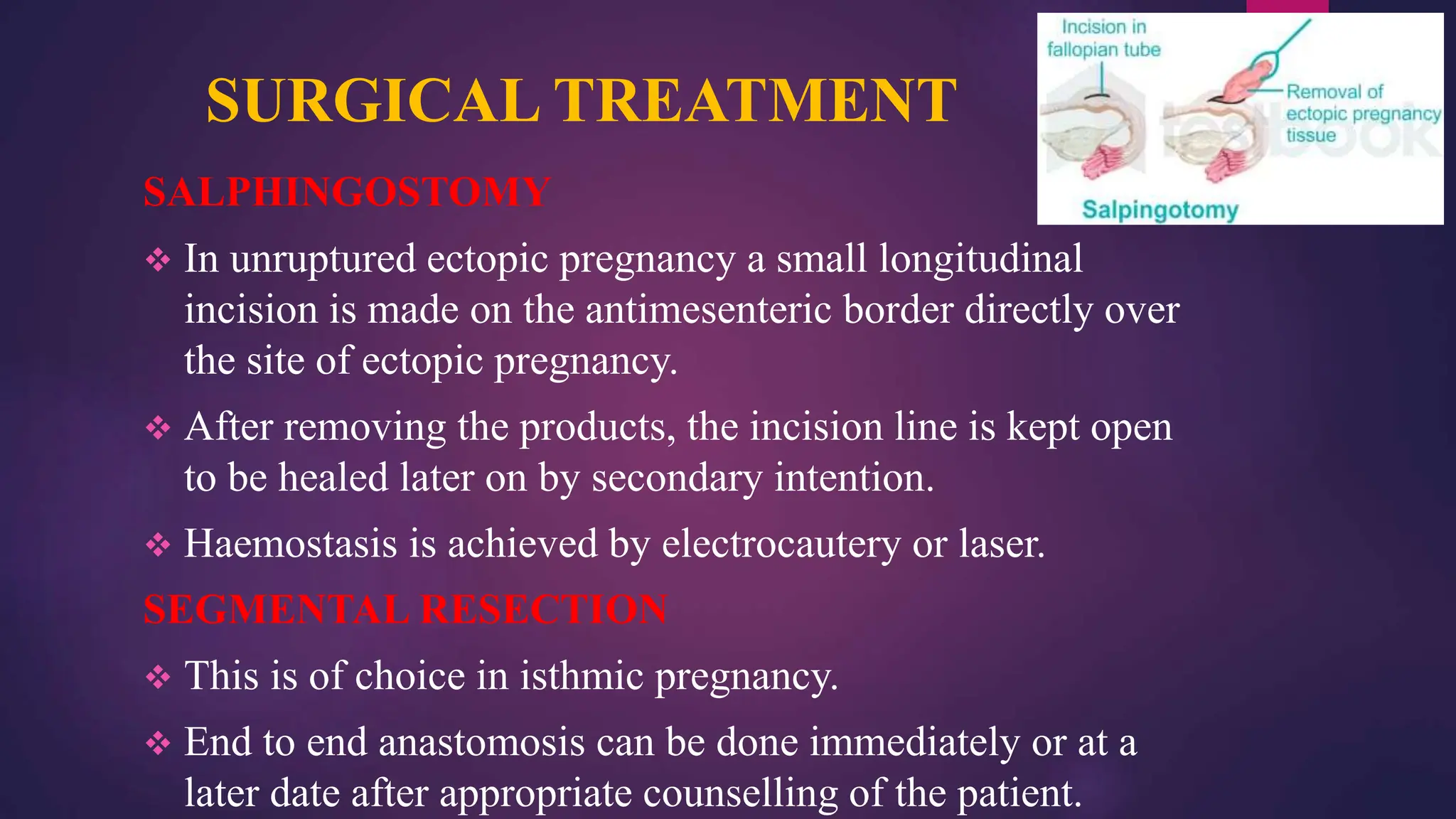 ECTOPIC PREGNANCY obstetrics and gynaecological nursing | PPTX