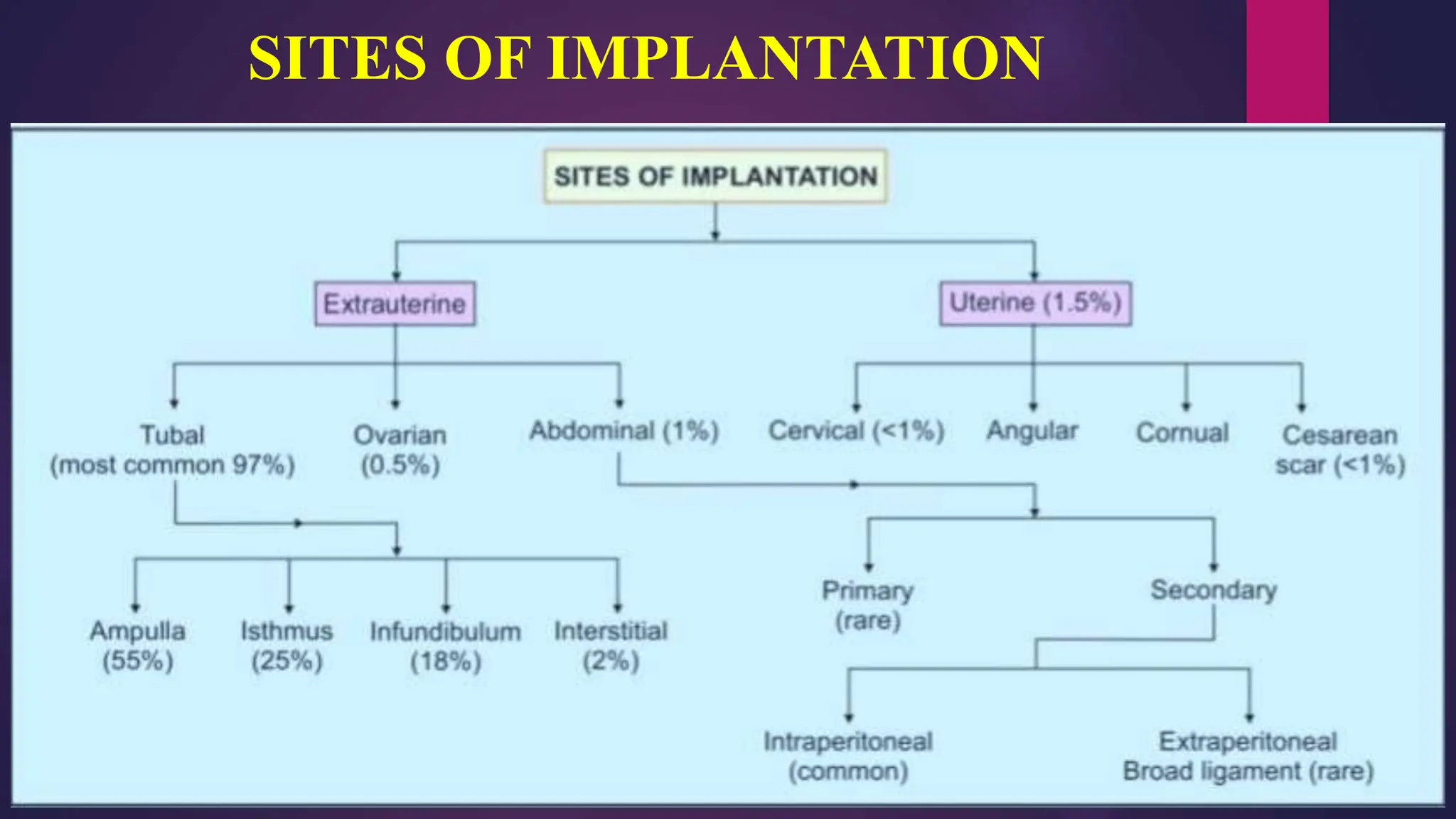 ECTOPIC PREGNANCY obstetrics and gynaecological nursing | PPTX