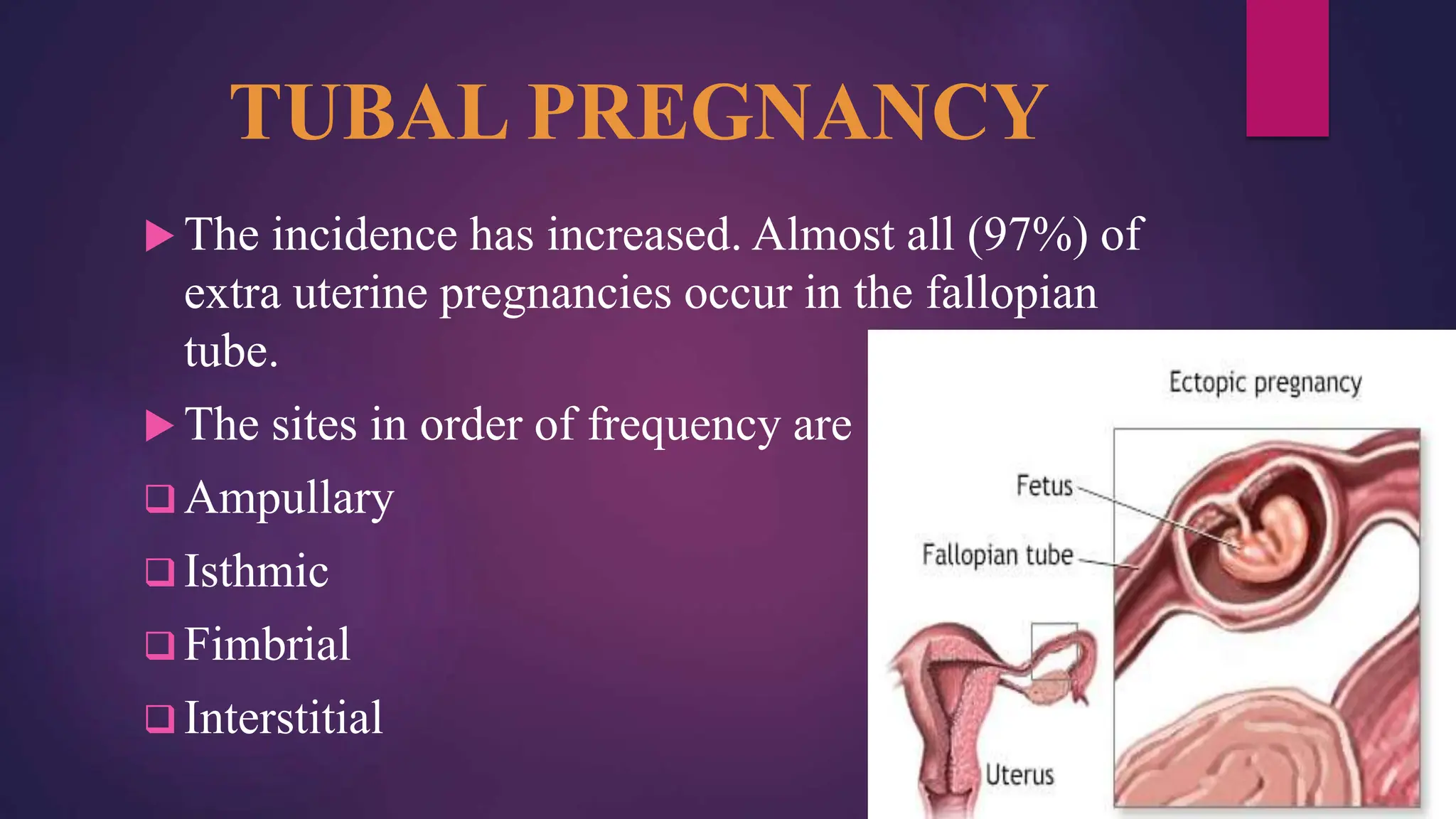 ECTOPIC PREGNANCY obstetrics and gynaecological nursing | PPTX