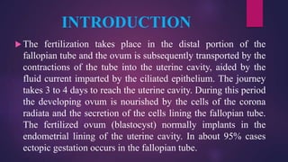 ECTOPIC PREGNANCY obstetrics and gynaecological nursing | PPTX