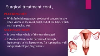 ECTOPIC PREGNANCY obstetrics and gynaecological nursing | PPTX