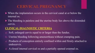 ECTOPIC PREGNANCY obstetrics and gynaecological nursing | PPTX