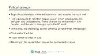 Ectopic pregnancy.pptx