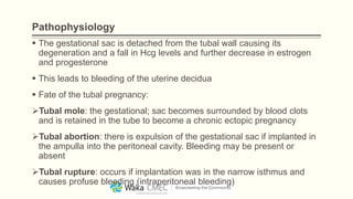Ectopic pregnancy.pptx