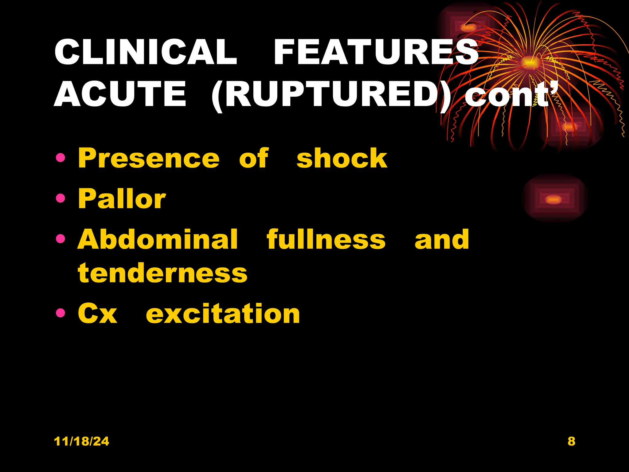ECTOPIC PREGNANCY. pptx | PPT