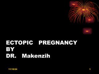ECTOPIC PREGNANCY. pptx | PPT