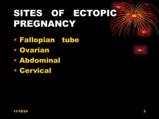 ECTOPIC PREGNANCY. pptx | PPT
