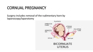 ectopic pregnancy presentation for obs and gyne | PPTX