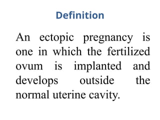 Powerpoint presentation Ectopic Pregnancy.pptx