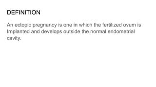 ECTOPIC PREGNANCY lecture for MBBS .pptx