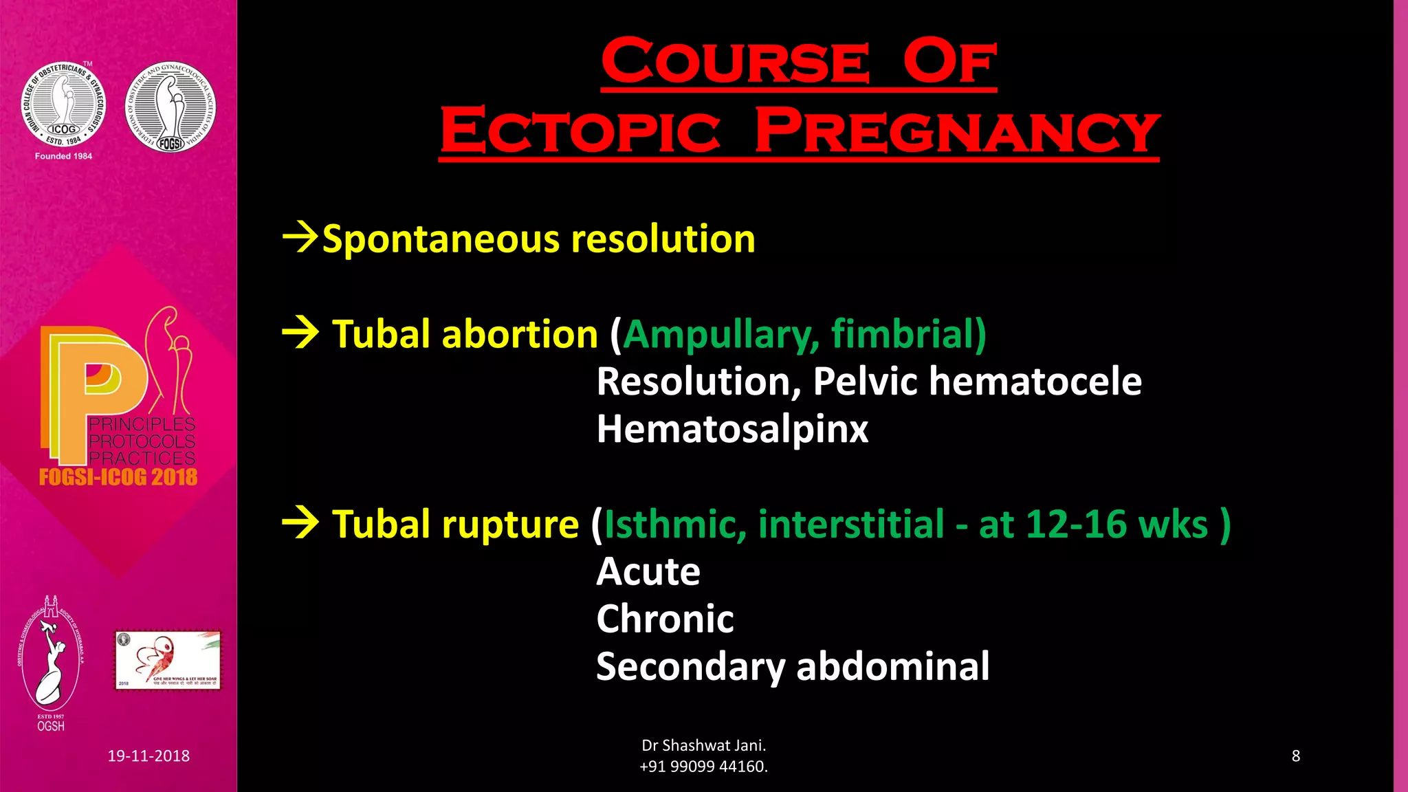 ECTOPIC PREGNANCY - FOGSI GUIDELINES BY DR SHASHWAT JANI | PDF