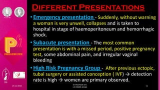 ECTOPIC PREGNANCY - FOGSI GUIDELINES BY DR SHASHWAT JANI | PDF