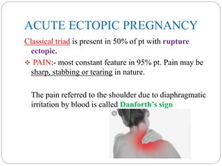 Ectopic pregnancy | PPTX