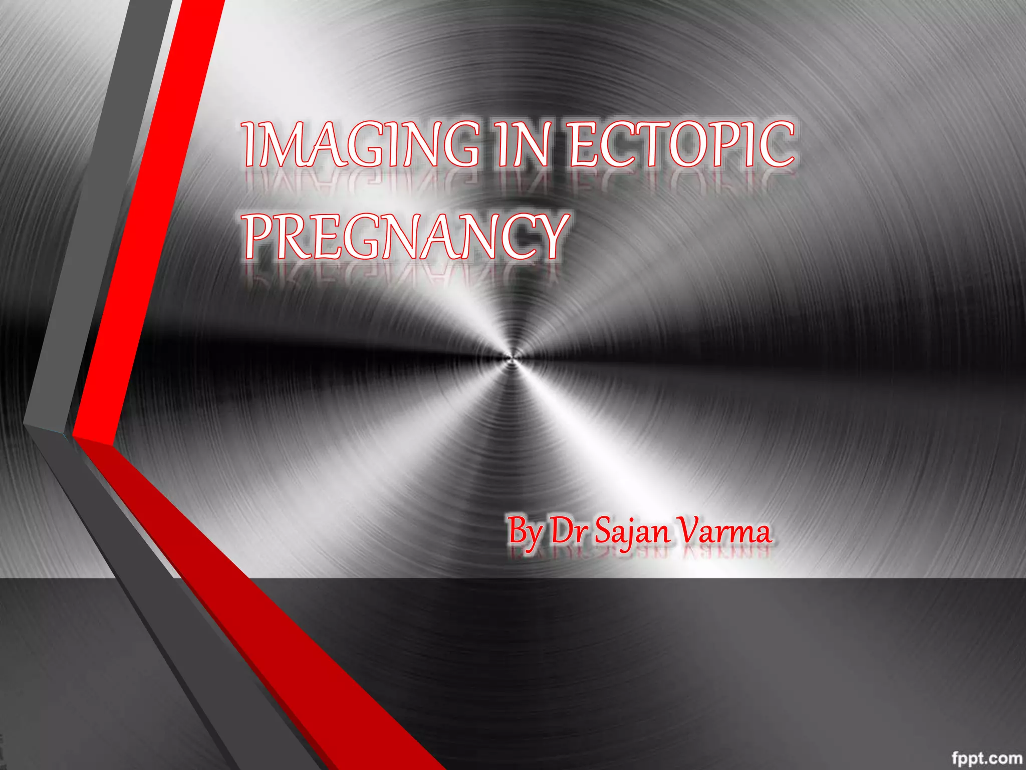 Ectopic Pregnancy Radiology Ppt