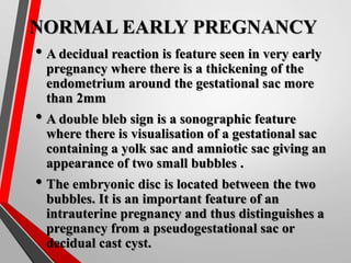 Ectopic pregnancy Radiology | PPTX