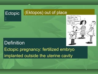 Ectopic pregnancy for undergraduate | PPT