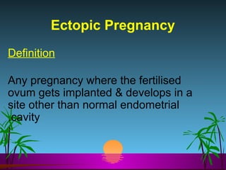 ectopic pregnancy ks.ppt,,,,,,,,,,,,,,,,,,,bleeding | PPT