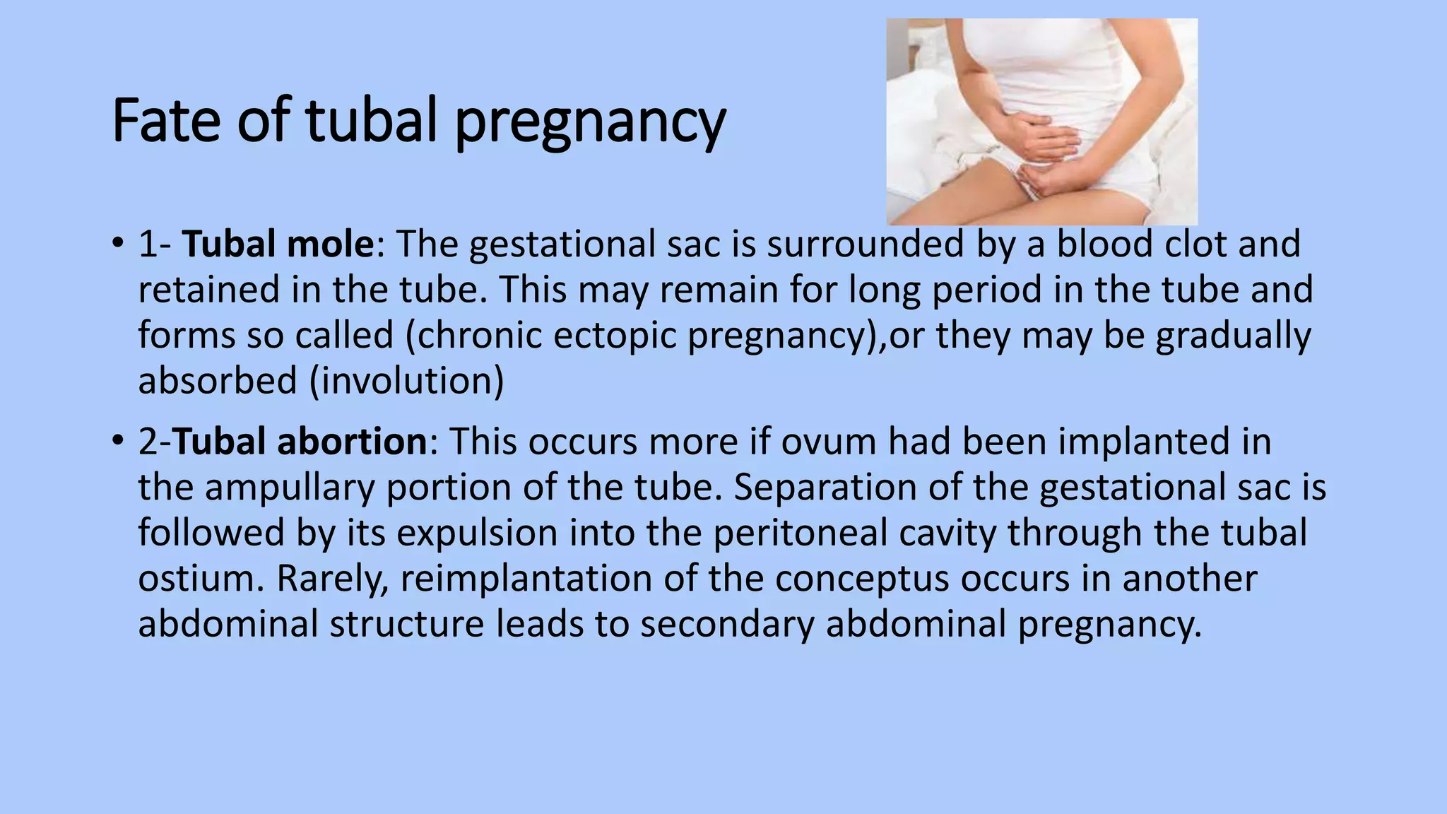 ECTOPIC PREGNANCY lecture.pptx