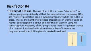ECTOPIC PREGNANCY lecture.pptx