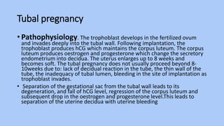 ECTOPIC PREGNANCY lecture.pptx