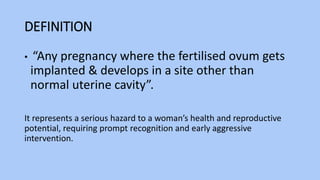 ECTOPIC PREGNANCY lecture.pptx