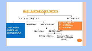ECTOPIC PREGNANCY lecture.pptx