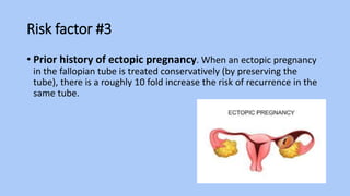 ECTOPIC PREGNANCY lecture.pptx