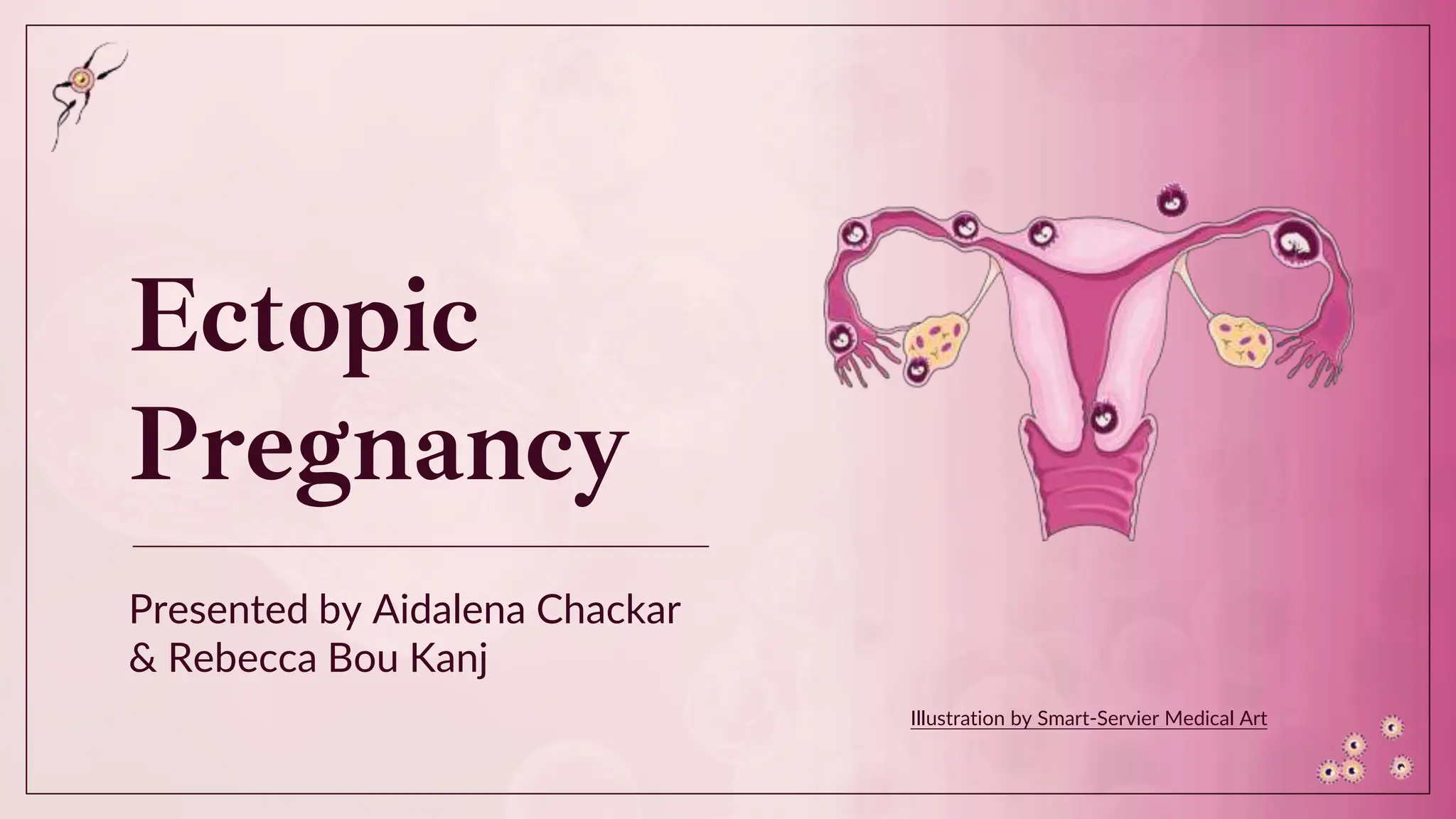 Ectopic Pregnancy : Definition, Triad, Diagnosis, and Treatment | PPTX