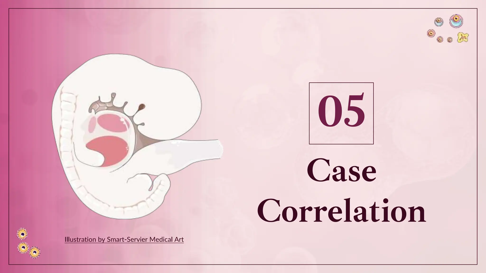 Ectopic Pregnancy : Definition, Triad, Diagnosis, and Treatment | PPTX