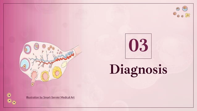 Ectopic Pregnancy : Definition, Triad, Diagnosis, and Treatment | PPTX