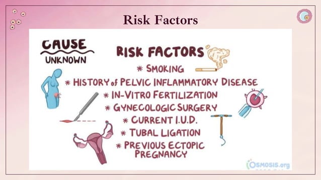 Ectopic Pregnancy : Definition, Triad, Diagnosis, and Treatment | PPTX