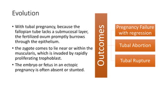 Ectopic Pregnancy | PPTX