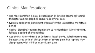 Ectopic Pregnancy | PPTX