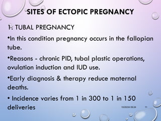 ECTOPIC_PREGNANCY_disorders of reproductive organs_1_(3)[1].ppt