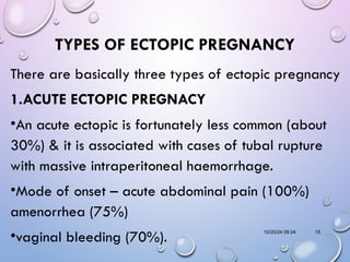 ECTOPIC_PREGNANCY_disorders of reproductive organs_1_(3)[1].ppt