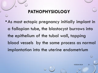 ECTOPIC_PREGNANCY_disorders of reproductive organs_1_(3)[1].ppt