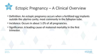 ectopic pregnency, causes, symptoms, diagnosis.pptx